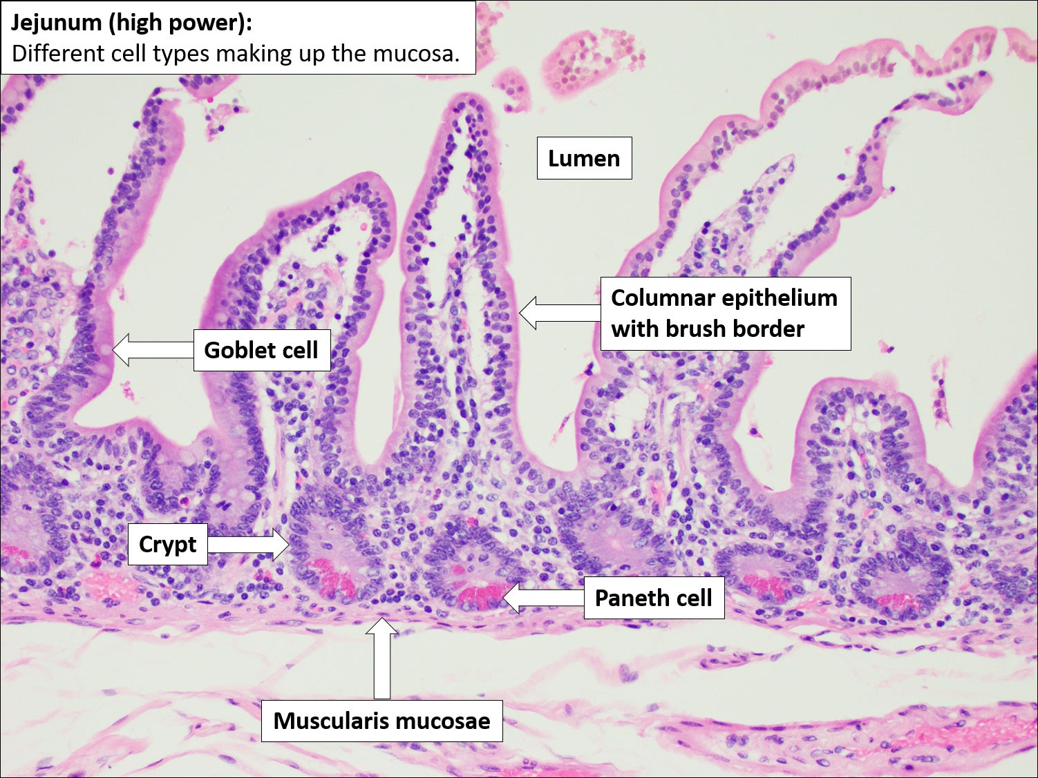 Goblet Small Intestine Histology Goblet Small Intestine Histology
