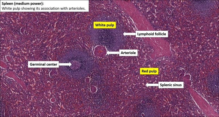Spleen – Normal Histology – NUS Pathweb :: NUS Pathweb