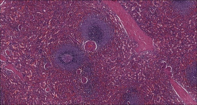 Spleen – Normal Histology – NUS Pathweb :: NUS Pathweb
