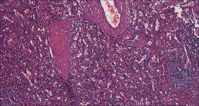 Spleen – Normal Histology – NUS Pathweb :: NUS Pathweb