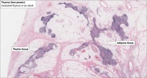 Thymus – Normal Histology – NUS Pathweb :: NUS Pathweb