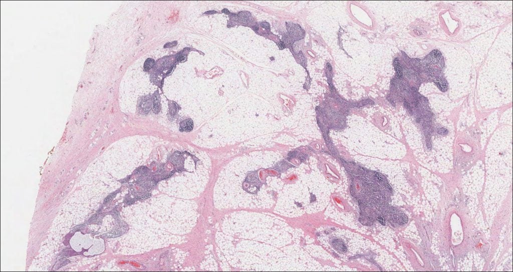 Thymus – Normal Histology – NUS Pathweb :: NUS Pathweb