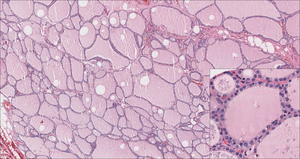 Thyroid – Normal Histology – NUS Pathweb :: NUS Pathweb