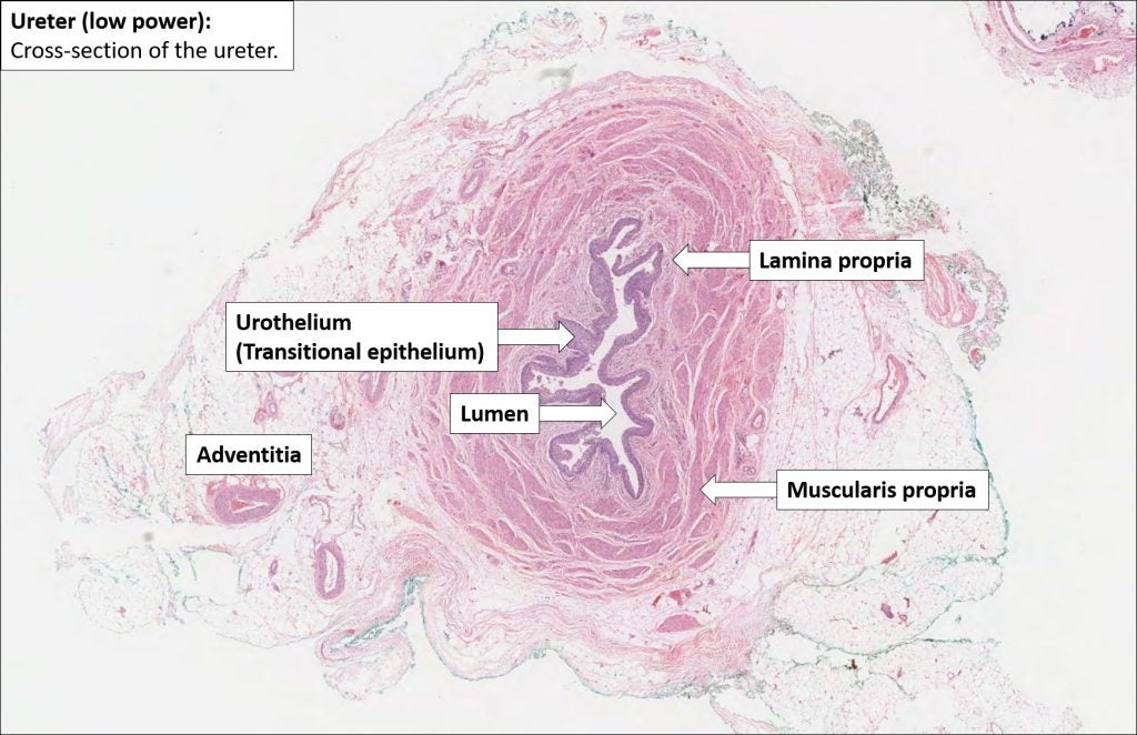 Ureter – Normal Histology – NUS Pathweb :: NUS Pathweb