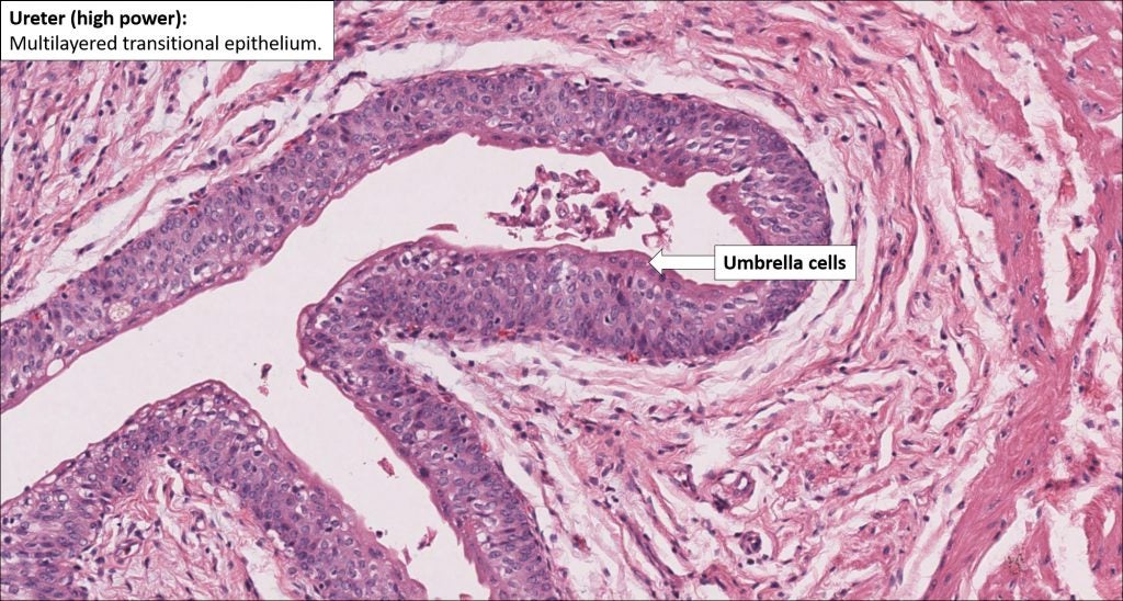 Ureter – Normal Histology – NUS Pathweb :: NUS Pathweb