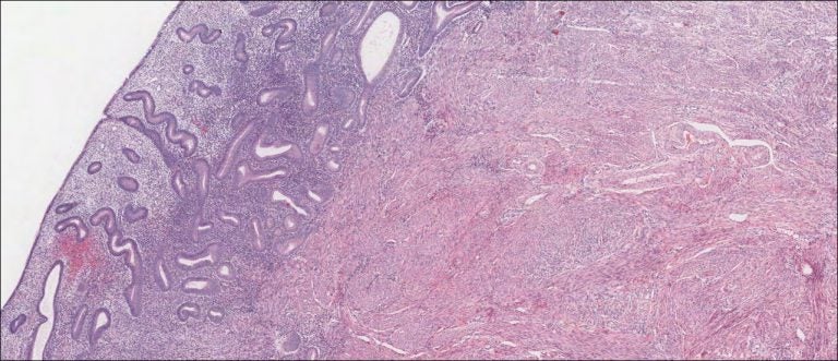Uterus – Normal Histology – NUS Pathweb :: NUS Pathweb