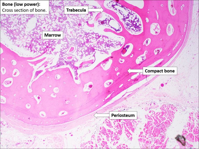 Bone – Normal Histology – NUS Pathweb :: NUS Pathweb