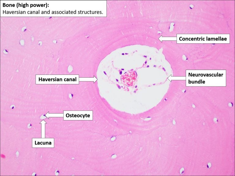 Bone – Normal Histology – NUS Pathweb :: NUS Pathweb
