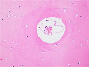 Bone – Normal Histology – NUS Pathweb :: NUS Pathweb