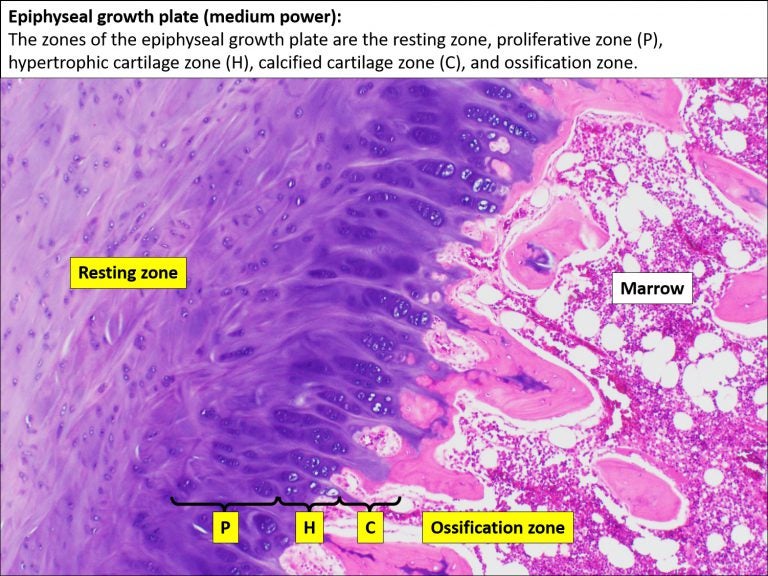 Bone – Normal Histology – NUS Pathweb :: NUS Pathweb