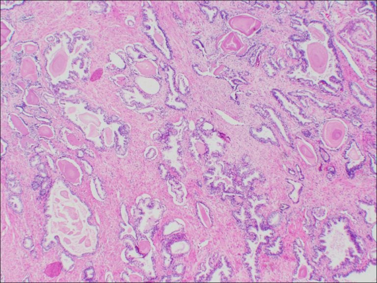 Prostate – Normal Histology – NUS Pathweb :: NUS Pathweb