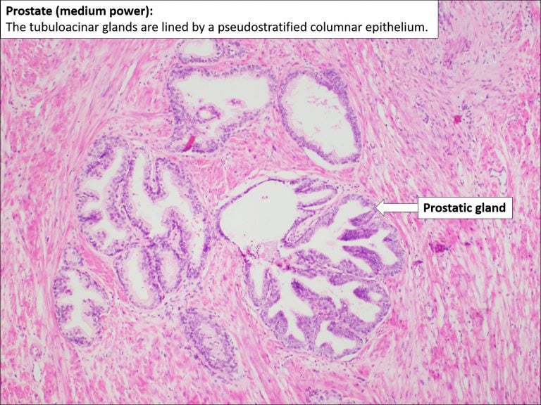 Prostate – Normal Histology – NUS Pathweb :: NUS Pathweb