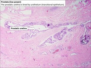 Prostate – Normal Histology – NUS Pathweb :: NUS Pathweb