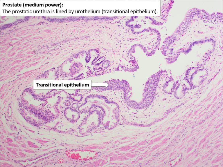 Prostate – Normal Histology – NUS Pathweb :: NUS Pathweb