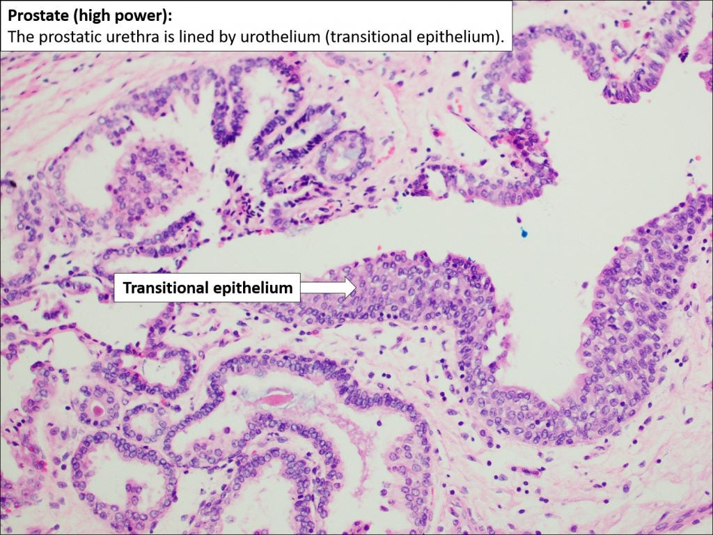 Prostate – Normal Histology – NUS Pathweb :: NUS Pathweb