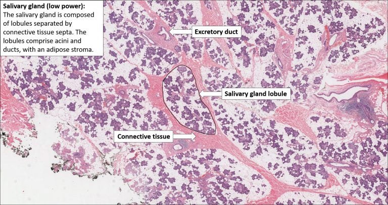 Salivary gland – Normal Histology – NUS Pathweb :: NUS Pathweb