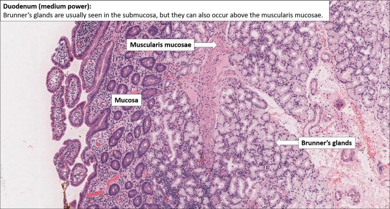 Small bowel – Normal Histology – NUS Pathweb :: NUS Pathweb