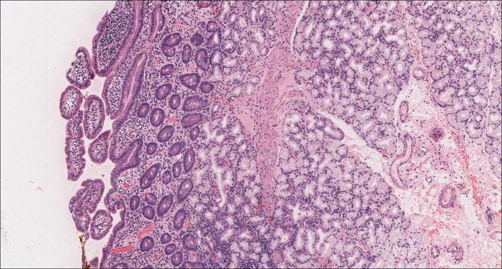 Small bowel – Normal Histology – NUS Pathweb :: NUS Pathweb