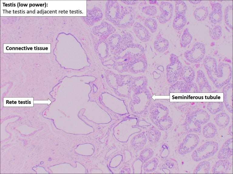 Testis and Epididymis – Normal Histology – NUS Pathweb :: NUS Pathweb