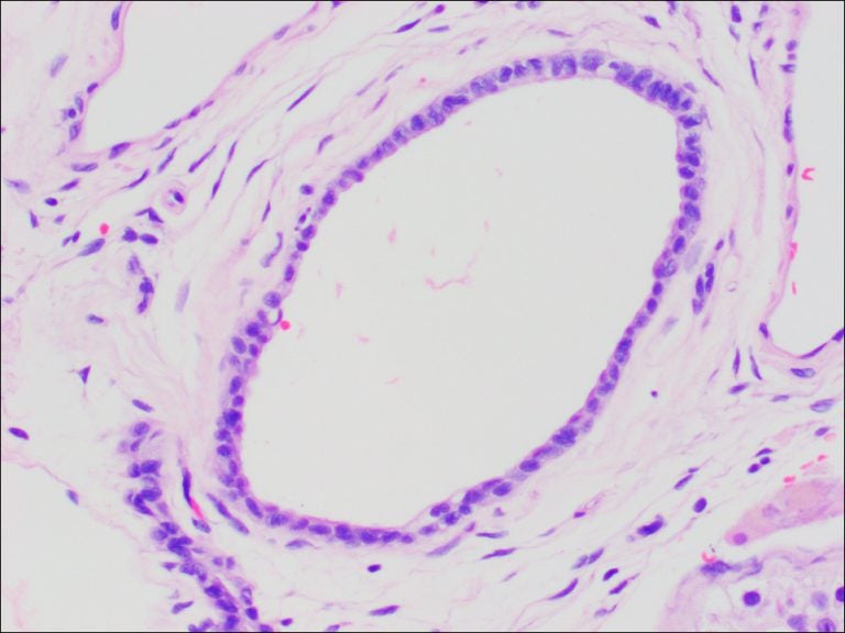 Testis and Epididymis – Normal Histology – NUS Pathweb :: NUS Pathweb