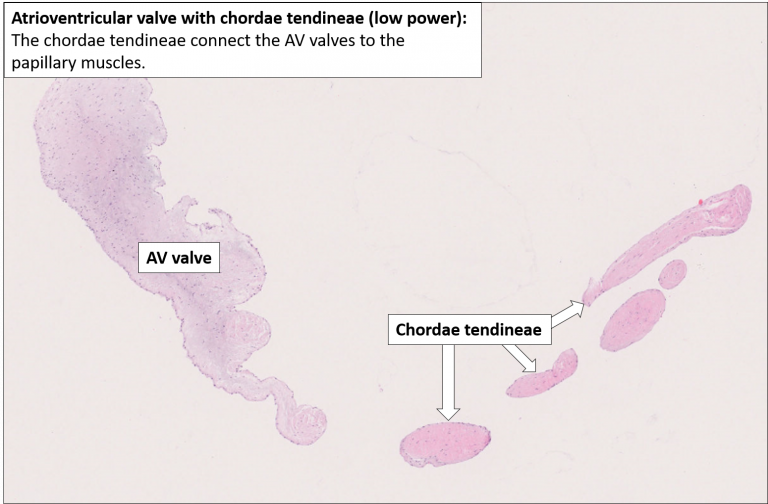 Atrioventricular valve with chordae tendineae – Normal Histology – NUS ...