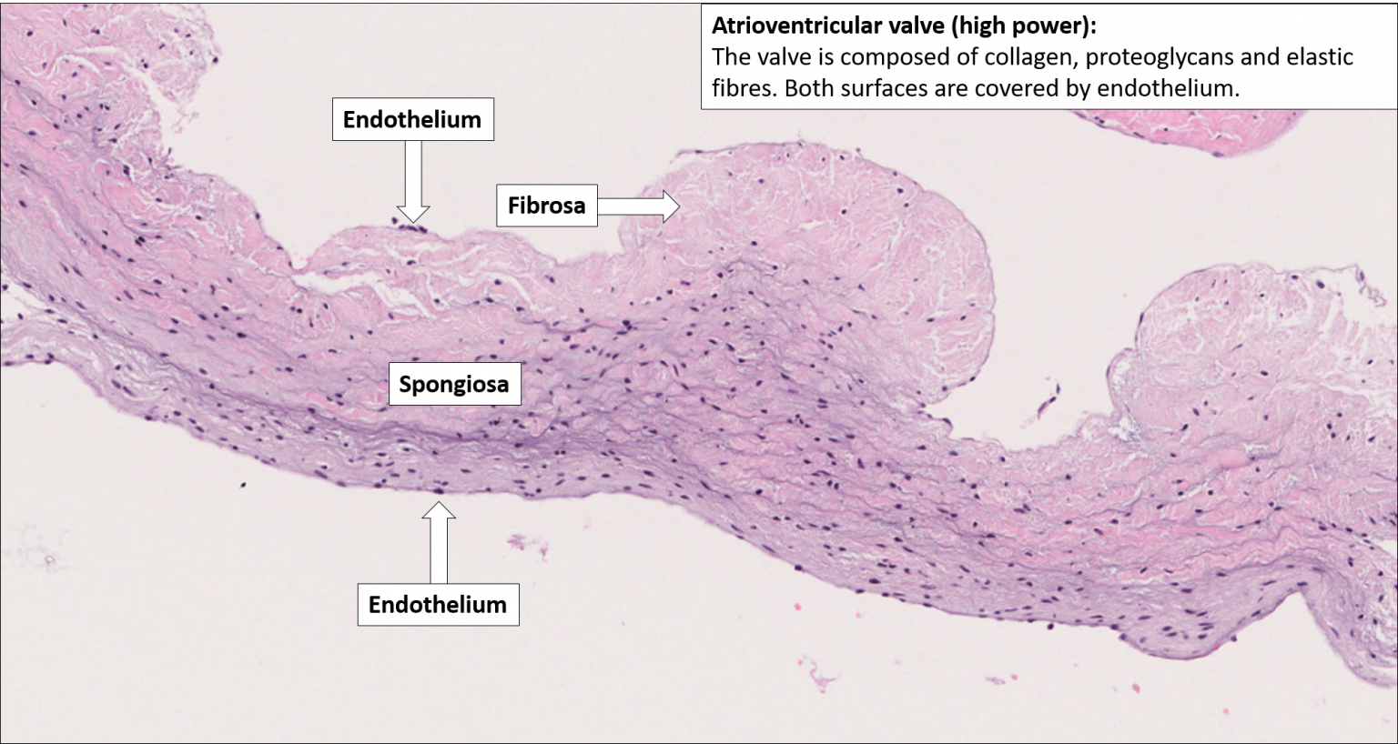 Atrioventricular valve with chordae tendineae – Normal Histology – NUS ...