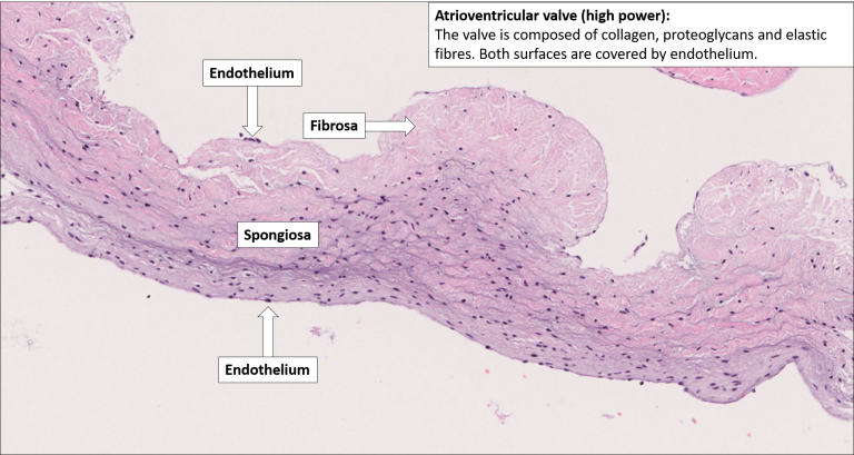 Atrioventricular valve with chordae tendineae – Normal Histology – NUS ...
