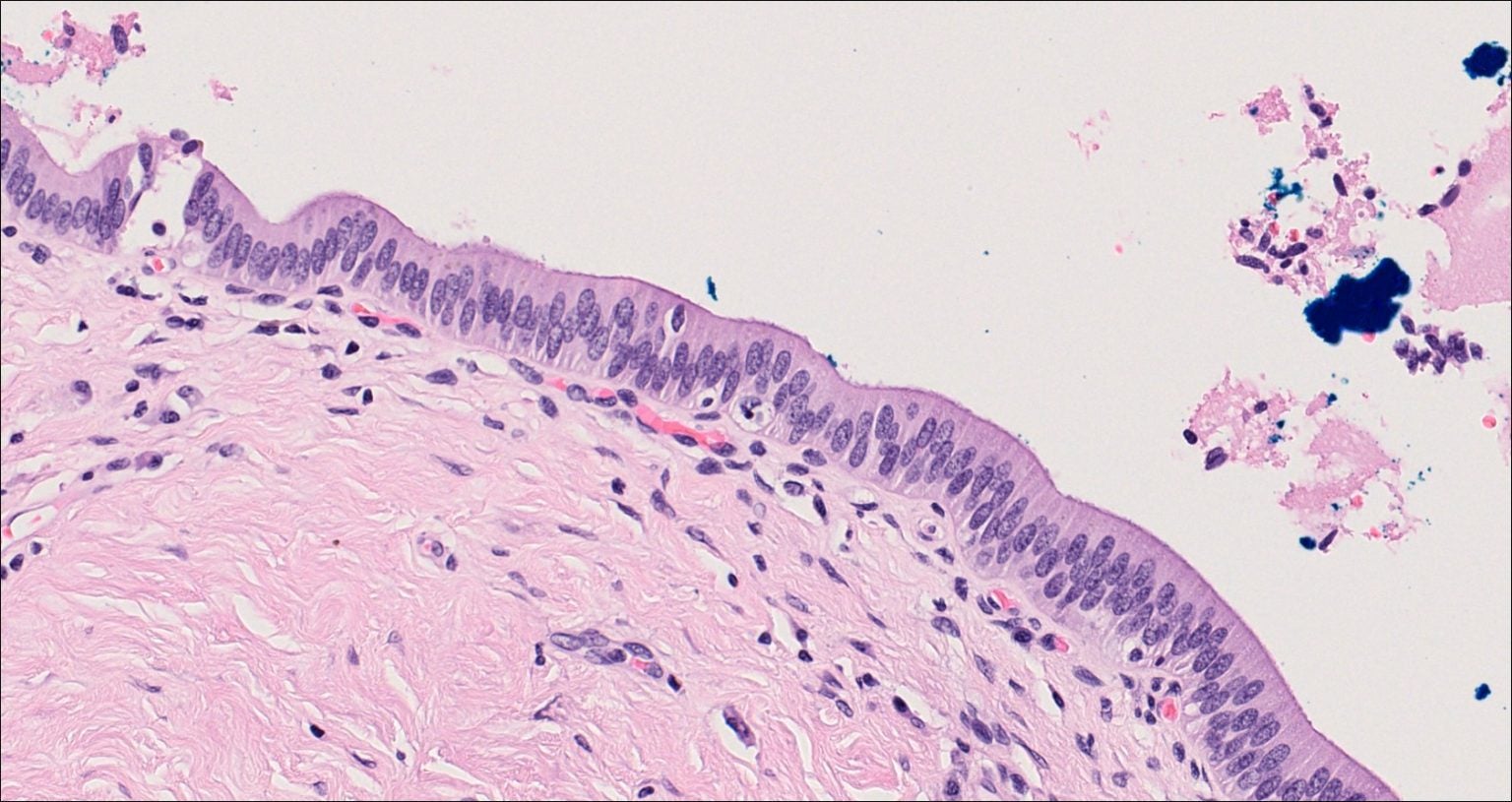 Bile duct – Normal Histology – NUS Pathweb :: NUS Pathweb