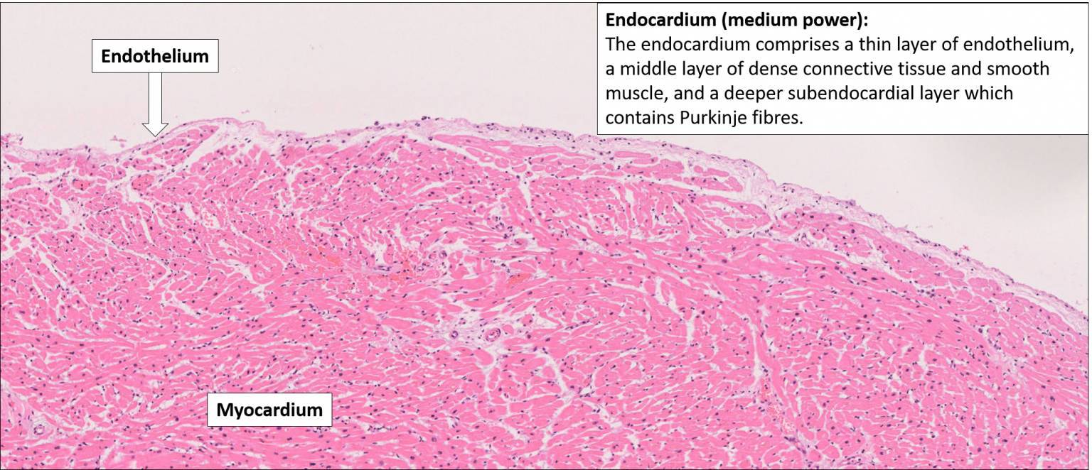 Heart – Normal Histology – NUS Pathweb :: NUS Pathweb