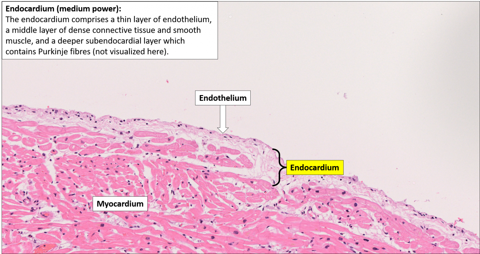 Heart – Normal Histology – NUS Pathweb :: NUS Pathweb