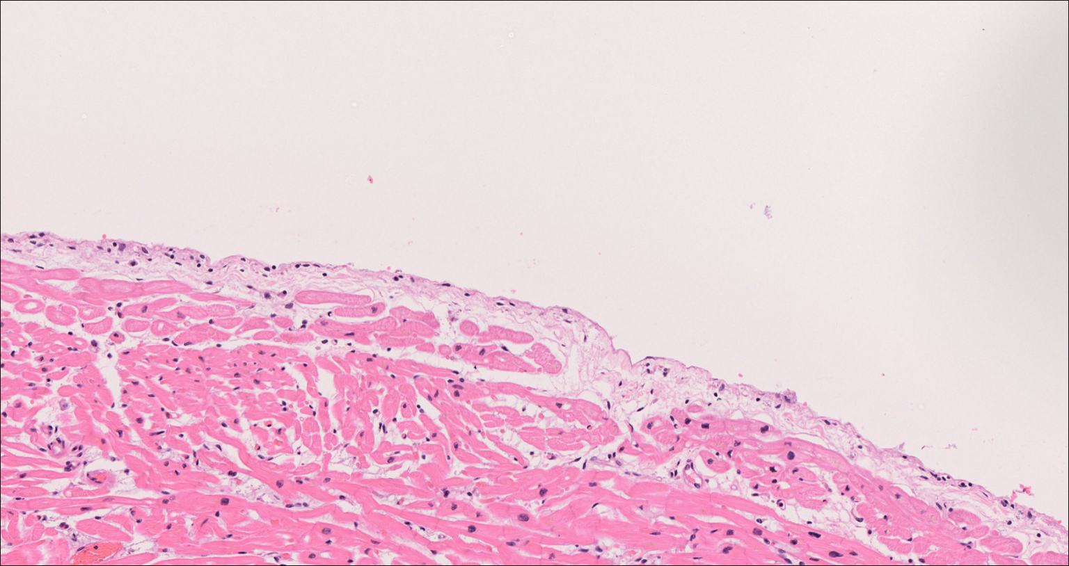 Heart – Normal Histology – NUS Pathweb :: NUS Pathweb