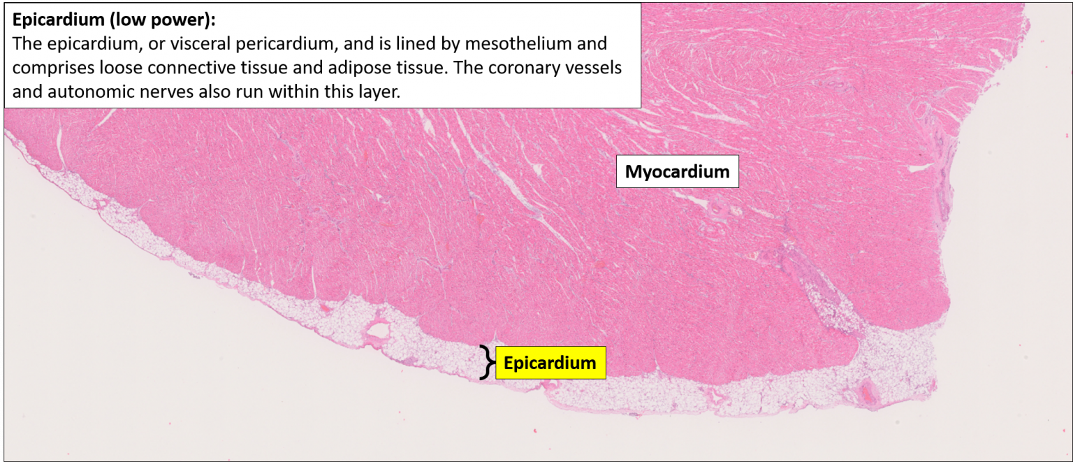 Heart – Normal Histology – NUS Pathweb :: NUS Pathweb