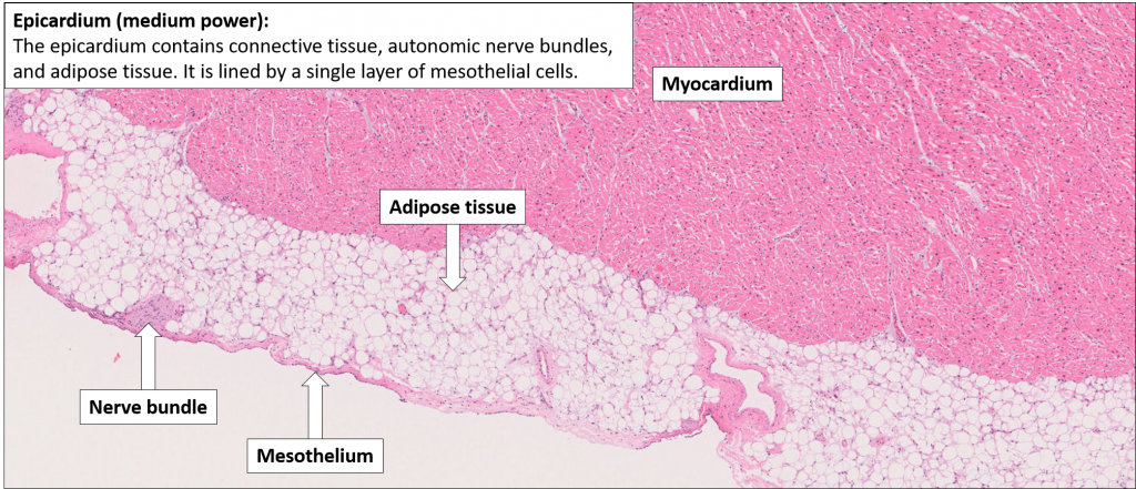 Heart – Normal Histology – NUS Pathweb :: NUS Pathweb