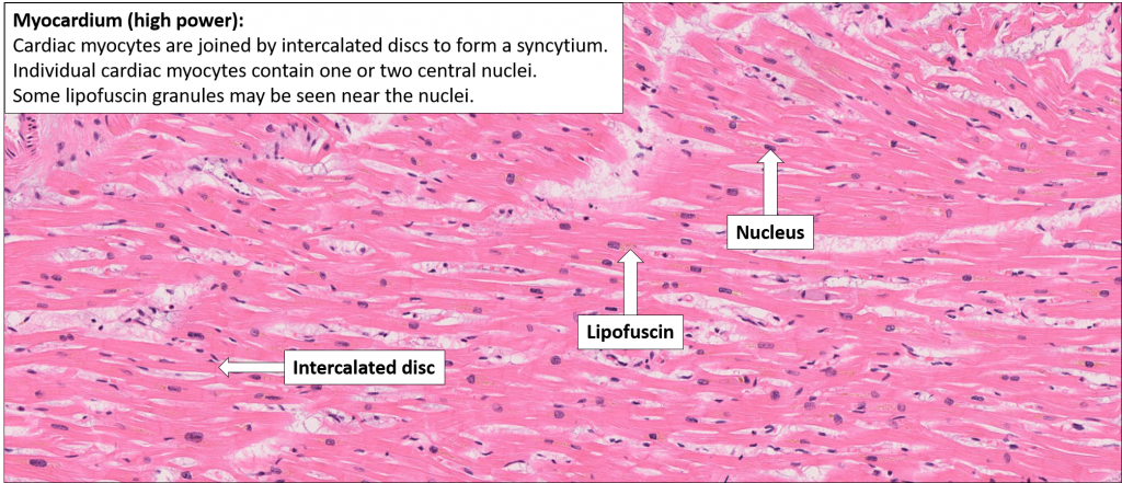 Heart – Normal Histology – NUS Pathweb :: NUS Pathweb