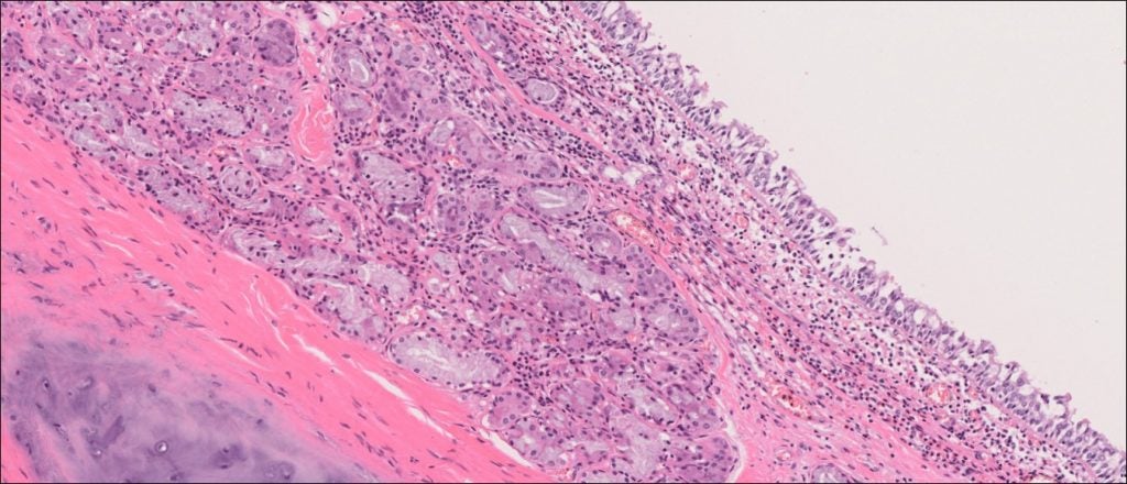 Trachea – Normal Histology – NUS Pathweb :: NUS Pathweb