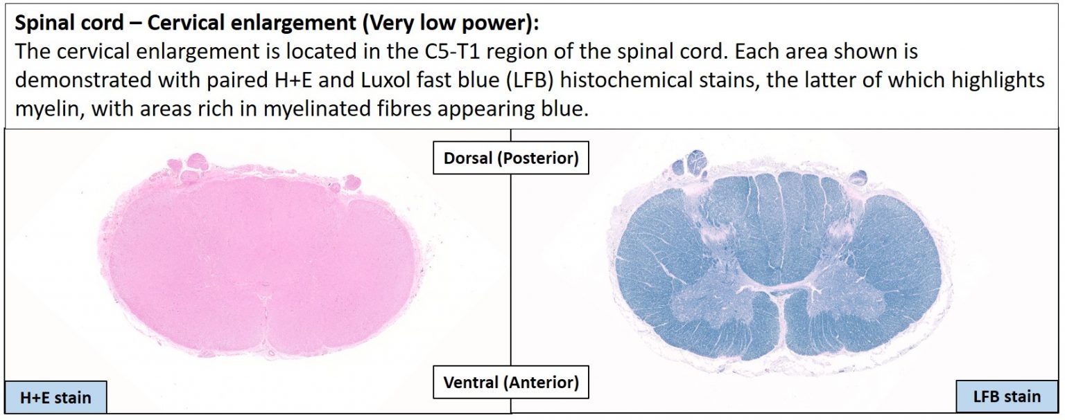 Spinal cord – NUS Pathweb :: NUS Pathweb