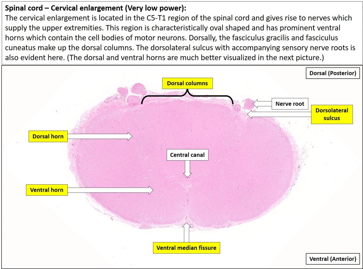 Spinal cord – NUS Pathweb :: NUS Pathweb