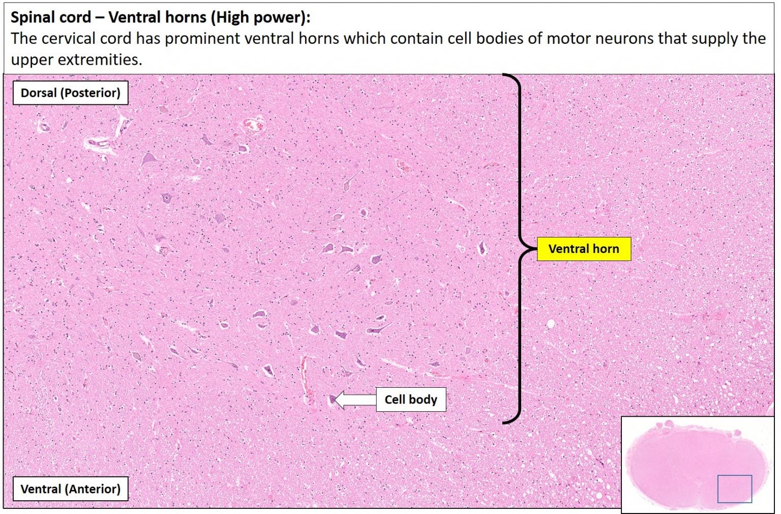 Spinal cord – NUS Pathweb :: NUS Pathweb