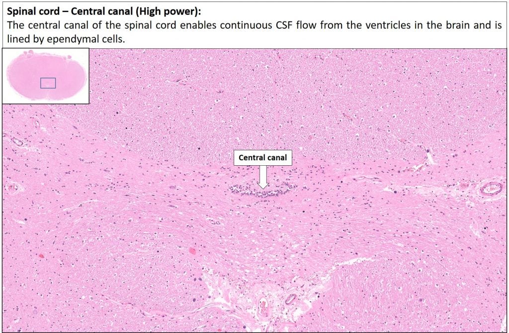 Spinal cord – NUS Pathweb :: NUS Pathweb