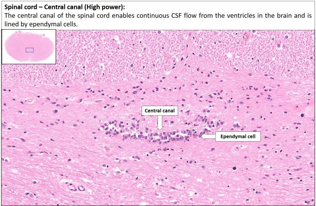 Spinal cord – NUS Pathweb :: NUS Pathweb
