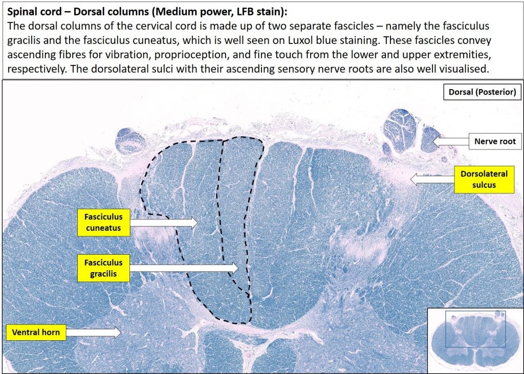 Spinal cord – NUS Pathweb :: NUS Pathweb