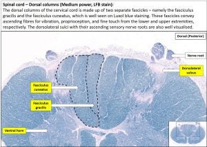 Spinal cord – NUS Pathweb :: NUS Pathweb