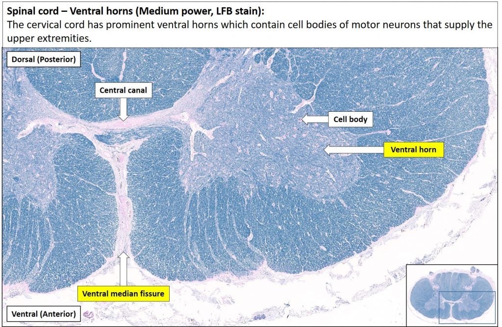 Spinal cord – NUS Pathweb :: NUS Pathweb
