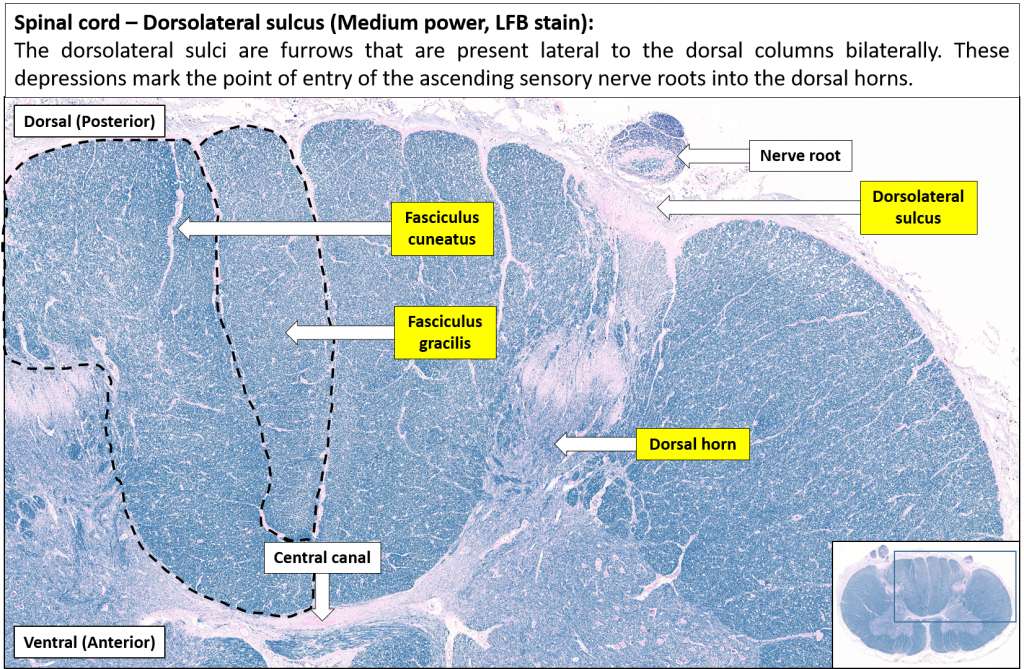 Spinal cord – NUS Pathweb :: NUS Pathweb