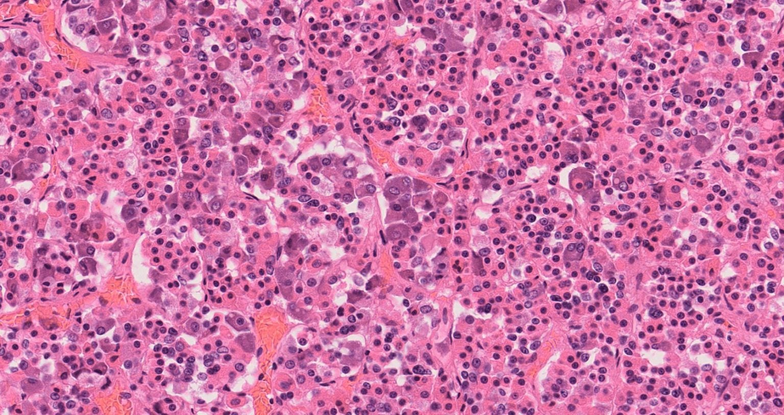 Brain – Pituitary – NUS Pathweb :: NUS Pathweb