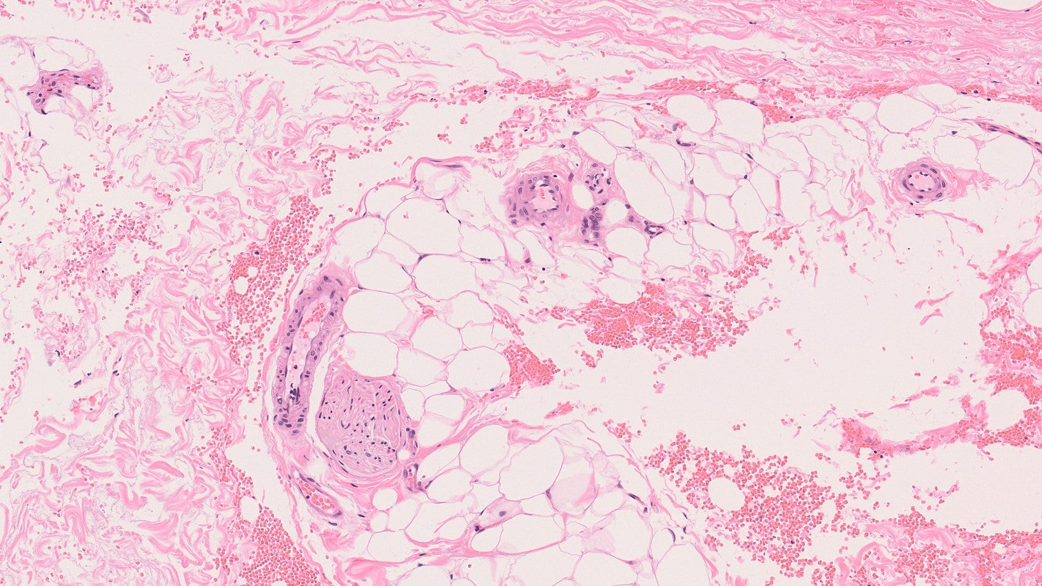 Blood vessels – Normal Histology – NUS Pathweb :: NUS Pathweb