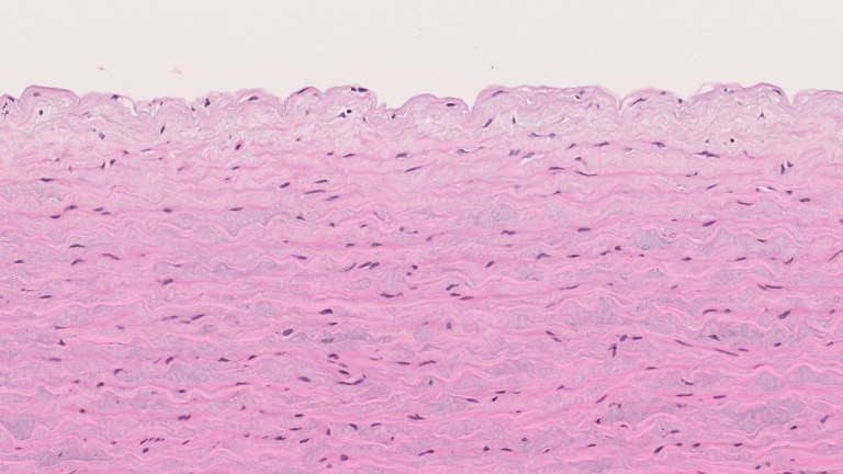 Blood vessels – Normal Histology – NUS Pathweb :: NUS Pathweb