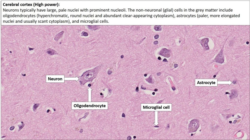 Brain – Cerebrum – NUS Pathweb :: NUS Pathweb