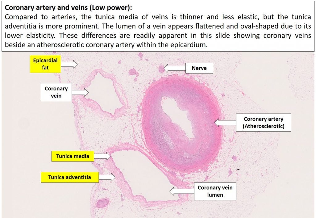 Blood vessels – Normal Histology – NUS Pathweb :: NUS Pathweb