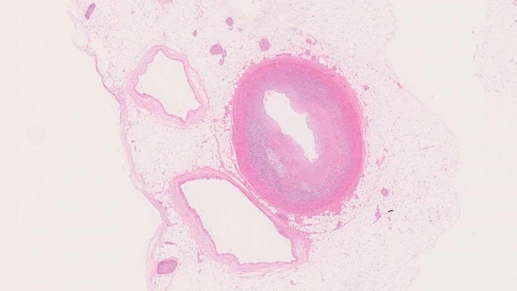 Blood vessels – Normal Histology – NUS Pathweb :: NUS Pathweb